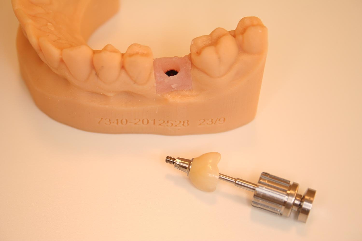 Implantaten – Tand & Implant